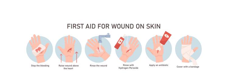 Emergency situation and first aid treatment Vector Image