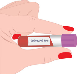 Blood cholesterol level laboratory test Royalty Free Vector