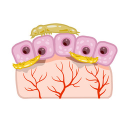 Subcutaneous Acne Vector Images (41)