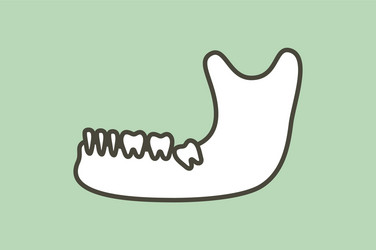 Impacted Teeth Vector Images (over 230)