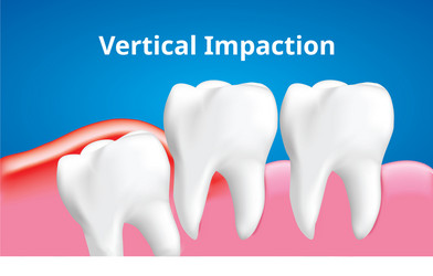 Tooth anatomy infographics realistic 3d Royalty Free Vector