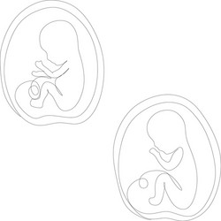 Baby Womb Sketch Vector Images (over 110)
