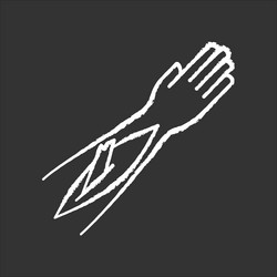 Open Fracture Vector Images (over 520)