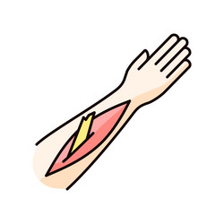 Open Fracture Vector Images (over 520)