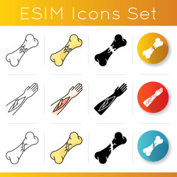 Open Fracture Vector Images (over 520)