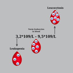 White blood cell count leukopenia leukocytosis Vector Image