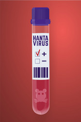 Hantavirus express test vacuum test tube Vector Image