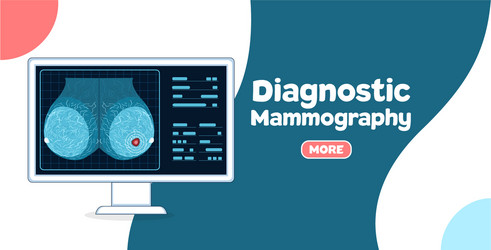 Diagnostic mammography banner Royalty Free Vector Image