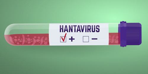Hantavirus express test vacuum tube Royalty Free Vector