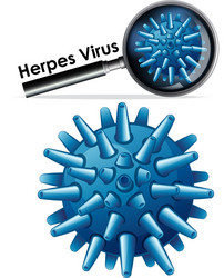 Herpes simplex virus with explanation Royalty Free Vector