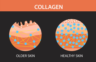 Collagen Skin Diagram Vector Images (over 260)