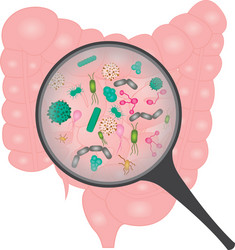 Small intestine bacterial overgrowth sibo Vector Image