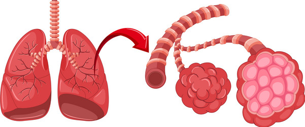 Diagram showing healthy and pneumonia lungs Vector Image
