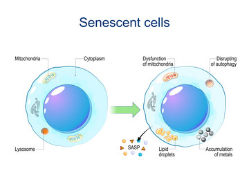 Sasp senescent cells and metabolic disease Vector Image