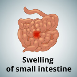 Realistic human sick small intestine isolated Vector Image
