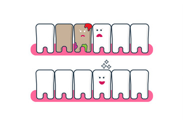 Yellow Teeth Dirty Vector Images (over 210)