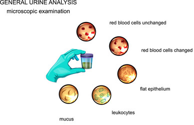 Urine Vector Images (over 11,000)