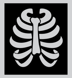 Chest X-Ray Vector Images (over 2,600)