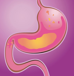 Peritoneum Vector Images (over 110)