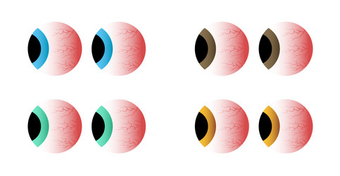 Red eyes frontal view set ill stress sleep Vector Image
