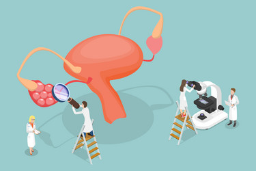 Polycystic Ovarian Syndrome Pcos Vector Images (37)