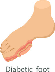 Diabetic Foot Vector Images (over 620)