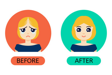 Balding woman before anf after hair treatment Vector Image