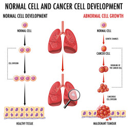 Cancer Cell Cartoon Vector Images (over 2,400)