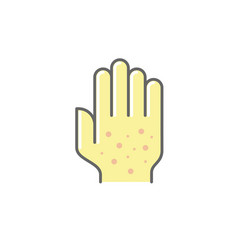 Cartoon hand with psoriasis or eczema Royalty Free Vector
