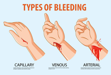 Bleeding Vector Images (over 9,400)