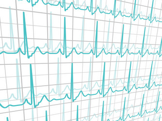 Cardiac Monitoring Trace Royalty Free Vector Image