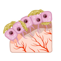 Subcutaneous Acne Vector Images (41)