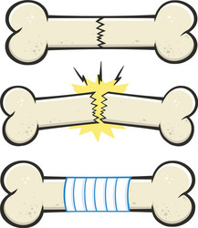 Cartoon Fracture Bone Vector Images (over 2,000)