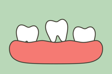 Cartoon Missing Tooth Vector Images (over 150)