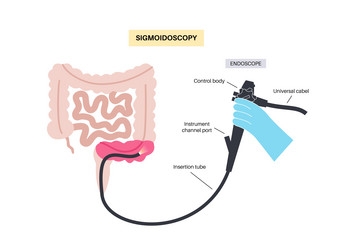 Sigmoidoscopy Vector Images (27)