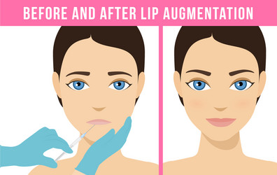 After Effects Vector Images (over 460)