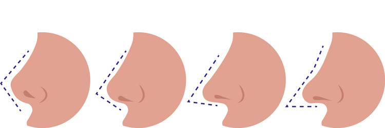 Female Nose Types