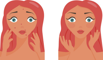 Poster infographics of skin problems Royalty Free Vector