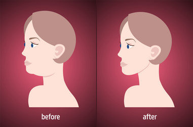 Woman with realistic double fat chin set Vector Image