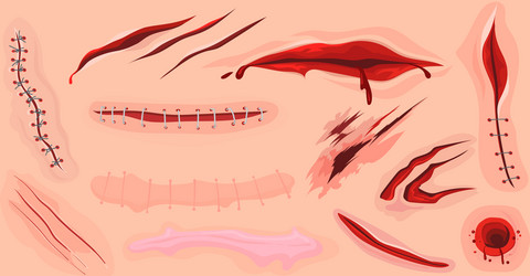 Scar Skin Vector Images (over 1,400)