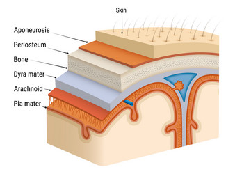 Acne vulgaris or pimple cross-section human Vector Image