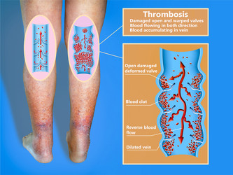 Dvt Vector Images (78)