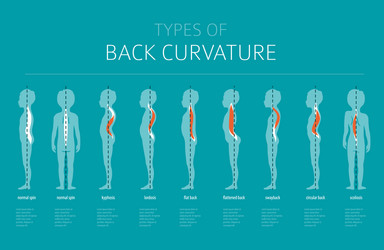 Types kids back curvature medical disease Vector Image