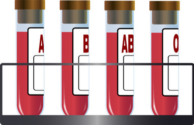 Blood group samples Royalty Free Vector Image - VectorStock