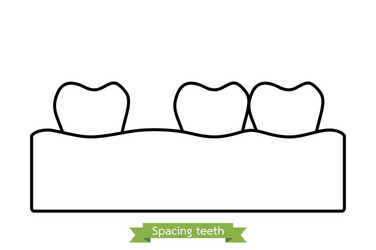 Gap Teeth Vector Images Over 140