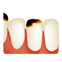 Caries Vector Images (over 17,000)
