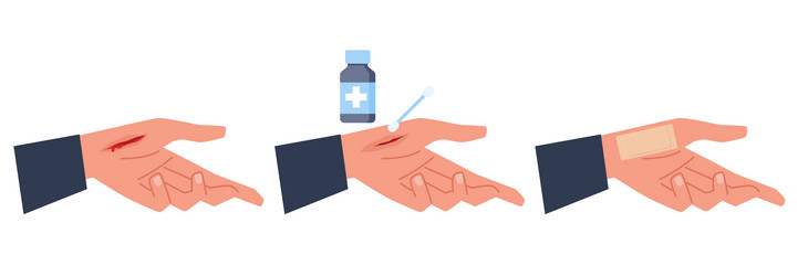Wound of hand kid skin scratch first aid for cut Vector Image