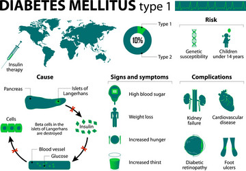 Types 1 diabetes mellitus Royalty Free Vector Image