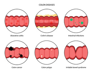 Internal Diseases Vector Images (over 26,000)