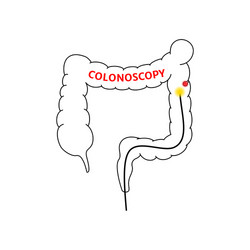 Colonoscopy Vector Images (over 640)